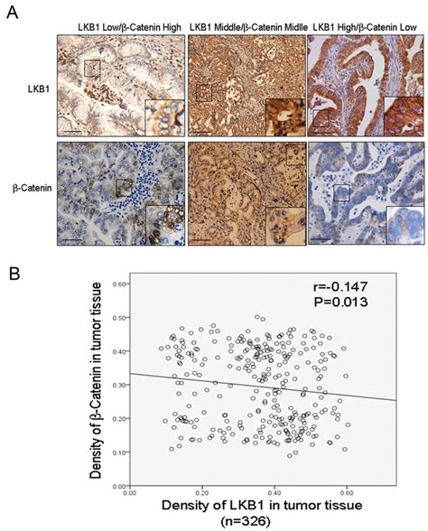 Inverse correlation between LKB and nuclear β catenin in ICC tissues Download Scientific