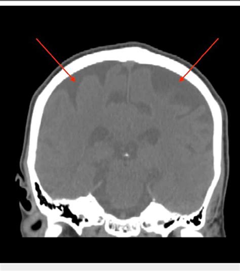Figure 1 From The Role Of The Anterior Cingulate Cortex And Insular