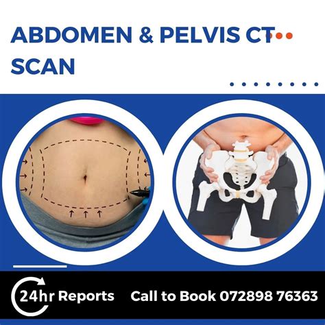 Abdomen And Pelvis Ct Scan Rs Call