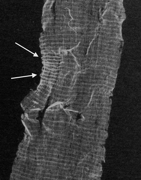 Detail Of An X Ray Photograph Of Fragment 1 The Arrows Indicate Where