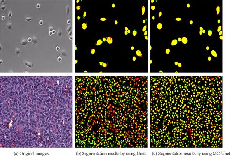 Figure 1 From Mc Unet Multi Scale Convolution Unet For Bladder Cancer