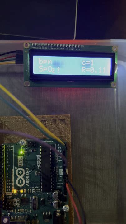 Saiteja Chilukuri On Linkedin Prototyping Project