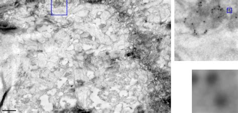Figure 1 From Stacked Denoising Autoencoders And Transfer Learning For Immunogold Particles