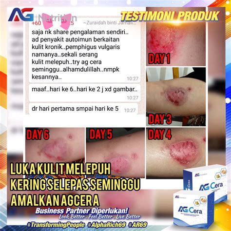 Ag Cera Suplemen Anti Oksidan Terbaik Di Dunia Kembali Sihat Dan