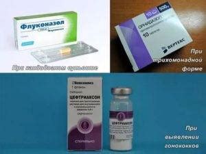 С помощью каких мазей можно лечить вульвит у женщин