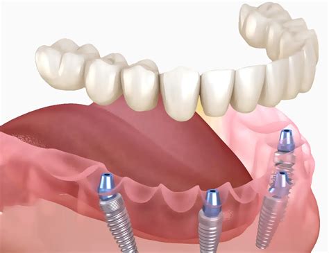 Swiss Dental Stomatološka Klinika U Zagrebu