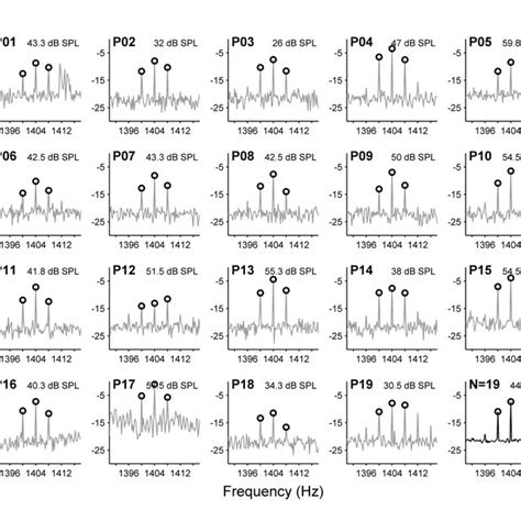 Dpoae Threshold Estimation Download Scientific Diagram