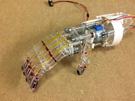 Low Cost Prosthesis By Matthew Thompson At Coroflot