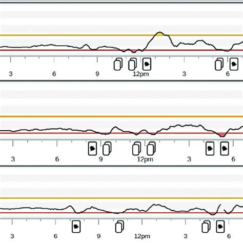 Excerpts From The G6 Continuous Glucose Monitoring System Dexcom Download Scientific Diagram