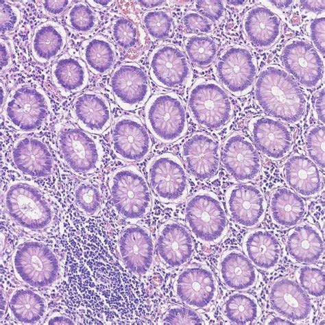 Different Applications Of The Tissue Classification In Computational Download Scientific