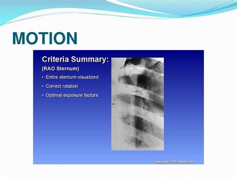 Ppt Artifact Analysis Powerpoint Presentation Free Download Id2043091