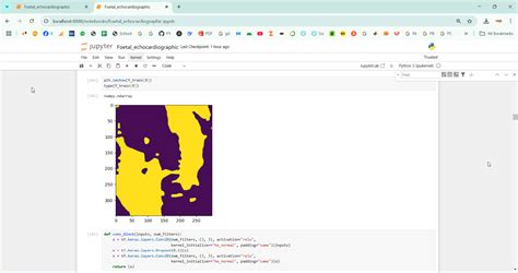 Foetal Segmentation Using Image In Python Projects