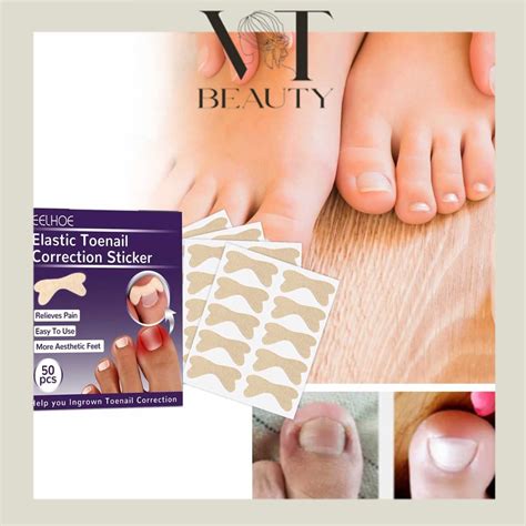 Adhesive Ingrown Toenail Patch Corrector Sticker 50pcs Shopee Malaysia