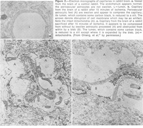 Figure 1 From The Role Of Cellular Swelling In The Pathogenesis Of Organ Ischemia Semantic