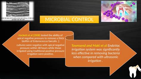 Pressure Irrigation In Endodontics And Dentistry Pptx