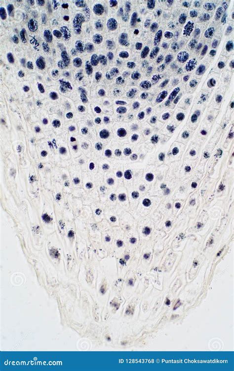 Root Tip Of Onion And Mitosis Cell In The Root Tip Stock Photo Image Of Centromeres Apoptosis