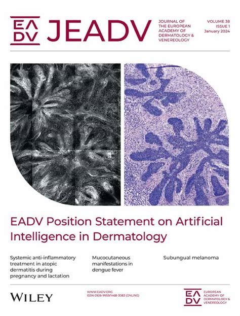 Risk Factors For Malignancy In Adult‐onset Dermatomyositis Bednar 2024 Journal Of The