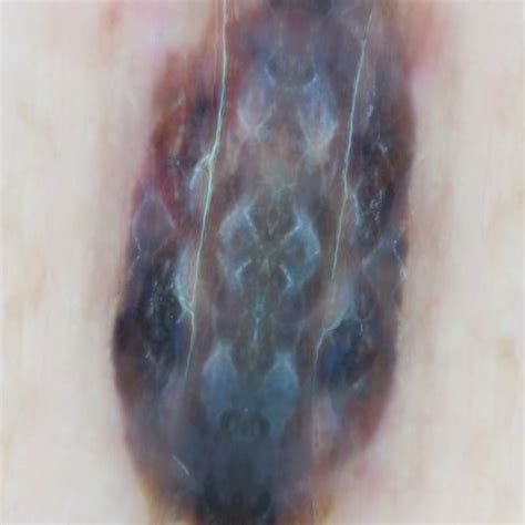 Generated Images Have Geometrical Pattern Issue NVlabs Stylegan GitHub