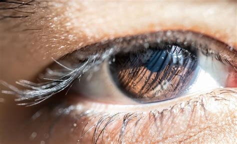 What Causes Eye Miosis Constricted Pupils