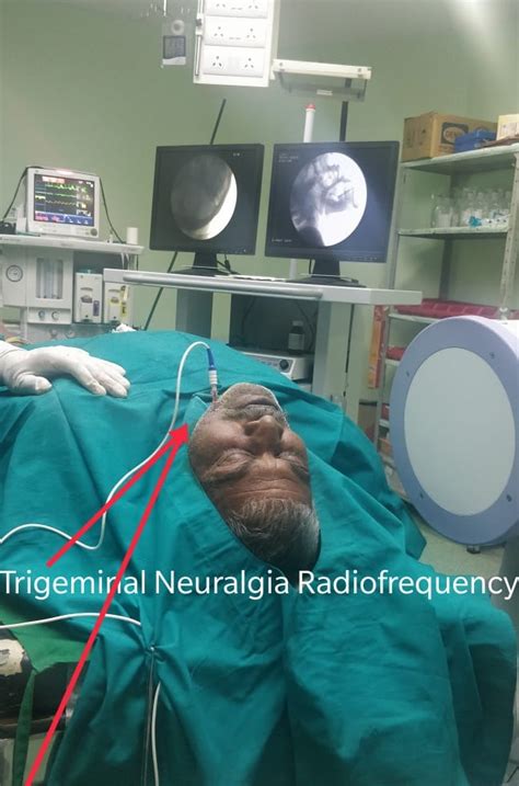 Best Trigeminal Neuralgia Treatment In Jaipur Trigeminal Neuralgia Hospital In Jaipur