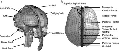 Finite Element Fe Model Of The Human Head A Isometric View Of The Download Scientific