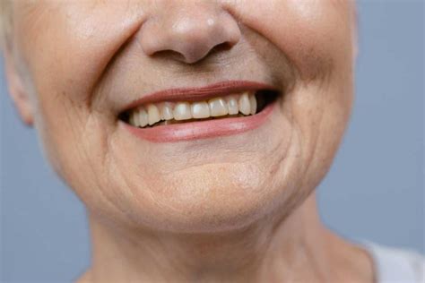 O Que é Placa Bacteriana Como Removê La E Preveni La Clínica