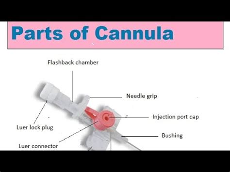 How To Insert IV Cannula IV Cannulation Techniques Part Of Cannula Cannula Nursing Nurse