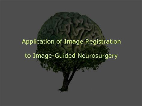 Image Registration And Application To Image Guided Neurosurgery Lara