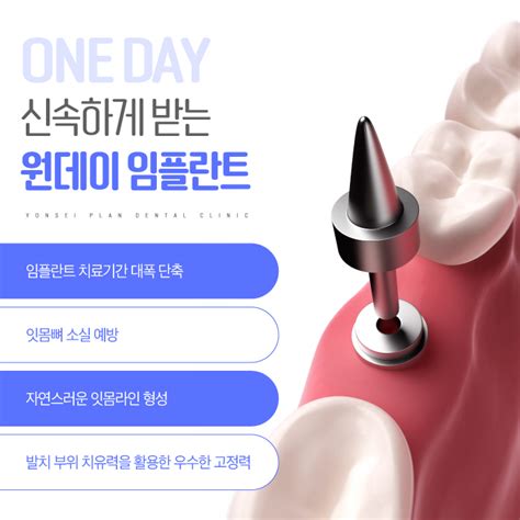 연세플랜치과 원데이 임플란트는 치과 내원 당일 치아 발치부터 임플란트 식립 그리고 임시보철물