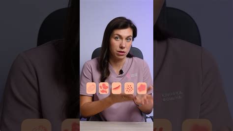 Зуд в интимном месте причины лечение сильный зуд в интимном месте