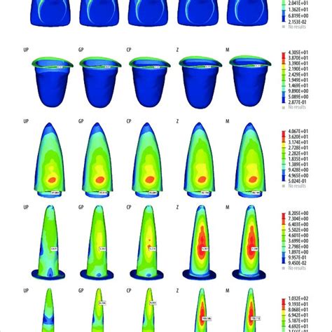 Analysis Models With 2 5 Mm And 3 5 Mm Diameters Periodontal Ligament Download Scientific