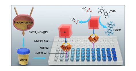 Iodide Enhanced Perovskite Nanozyme Based Colorimetric Platform For Detection Of Urinary Nuclear