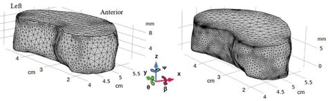 Two Models Of The Intervertebral Disc With Their Final Mesh Initial