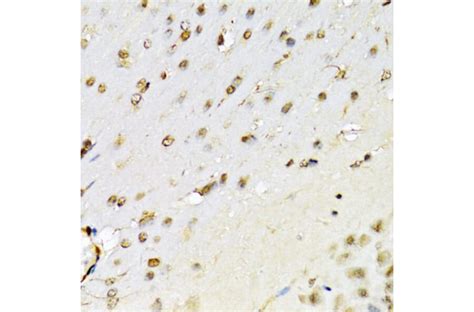 Anti Runx1 Aml1 Antibody A13839