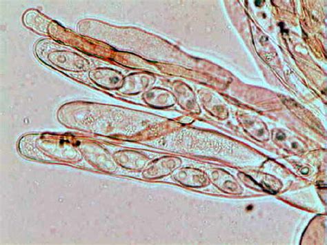 Ascospores Under Microscope