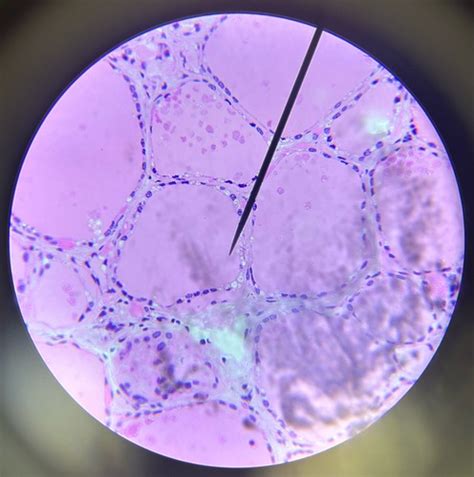 Bio 202 Microscope Slides Flashcards Quizlet