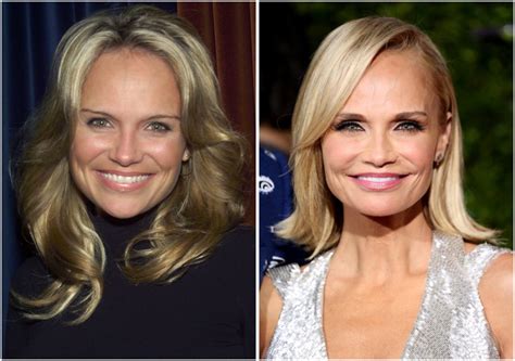 Has Kristin Chenoweth Had Plastic Surgery Life And Style
