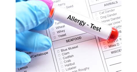 Allergy Testing