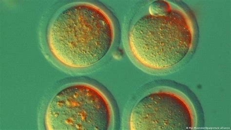 What Is A Stem Cell Transplant Health