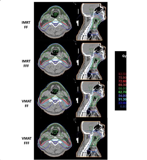 Comparison Of Dose Distributions Comparison Of Dose Distributions In