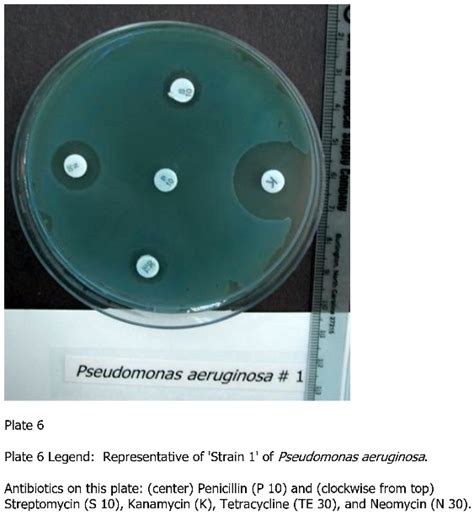 Pseudomonas Aeruginosa 1 Plate 6 Plate 6 Legend Representative Of