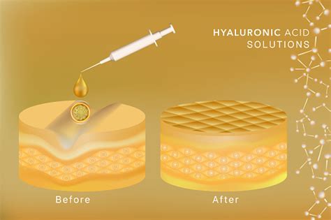 히 알루 론 산 전후 피부 솔루션 광고 골드 콜라겐 세럼 드롭 화장품 광고 배경 사용 준비 3d 그림에서 주사기 개념에 대한