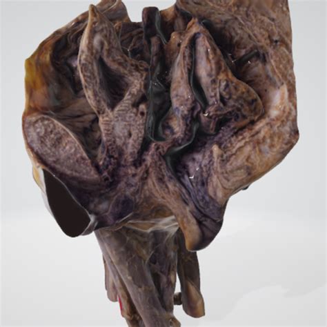 Stl File Groin And Spermatic Cord Anatomy ♂️ Obj・model To Download