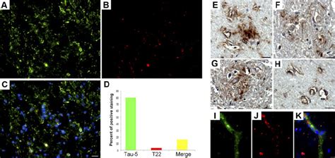 Tau Oligomers Constitute A Small Portion Of Total Tau In Ad Frontal