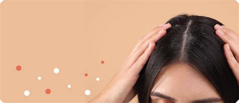 Себорейный дерматит причины признаки лечение себореи