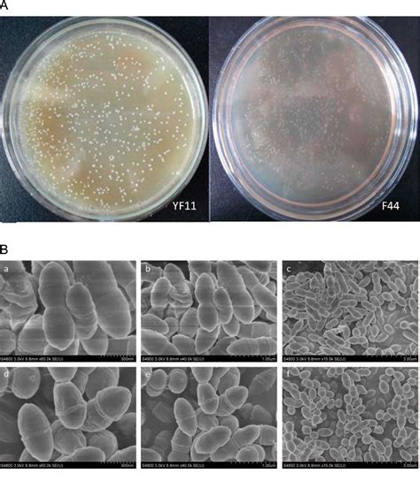 Figure 5 From Genome Shuffling Of Lactococcus Lactis Subspecies Lactis