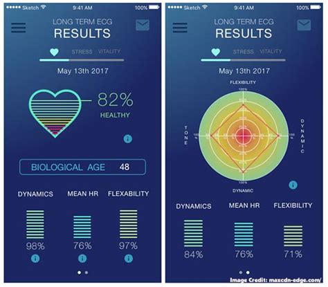 Ecg Guard You Need To Know To Monitor Heart Sleep And Stress