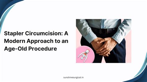 Stapler Circumcision A Modern Approach To An Age Old Procedure Sunshine Surgical Hospital