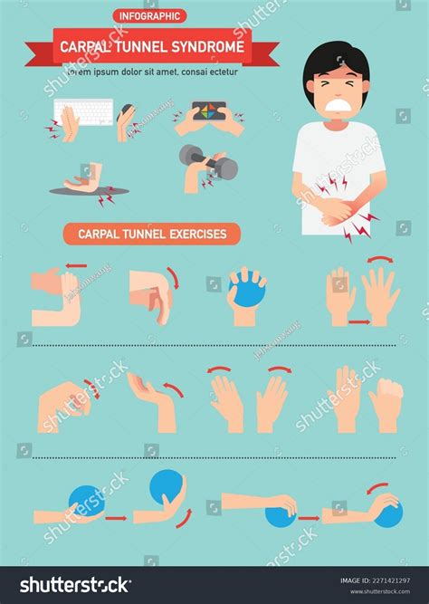 Carpal Tunnel Syndrome Infographic Vector Illustration Stock Vector