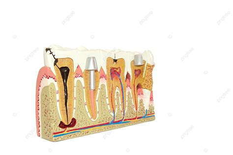 Model Prosthesis Background Images Hd Pictures And Wallpaper For Free